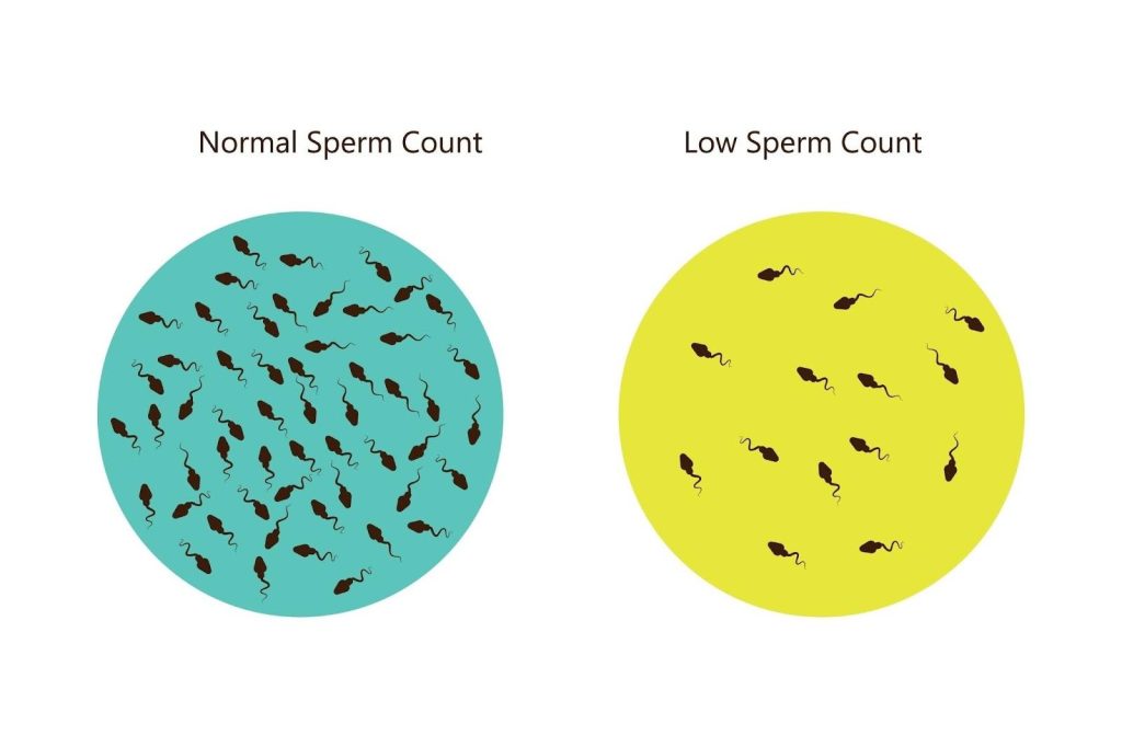 Low Testosterone Levels Singapore - Phoenix Medical Group