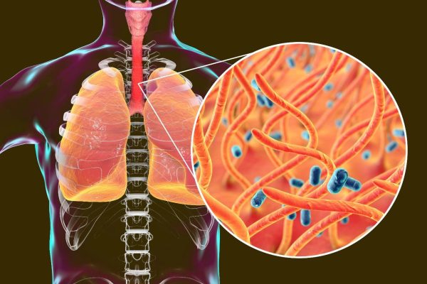 Who Needs the Boostrix Vaccine? What Adults Should Know About the Rise ...